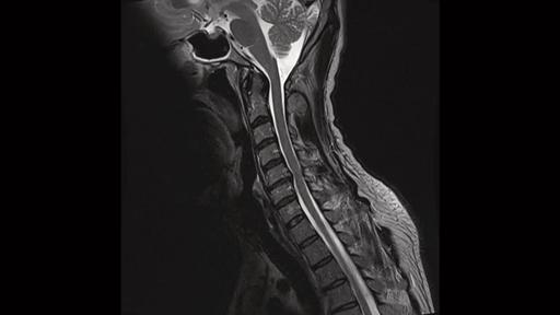 MAGNETOM Free.Max - Siemens Healthineers USA