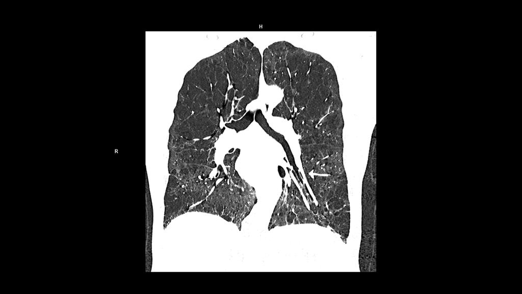 SOMATOM Pro.Pulse Dual Source CT scanner - Siemens Healthineers USA