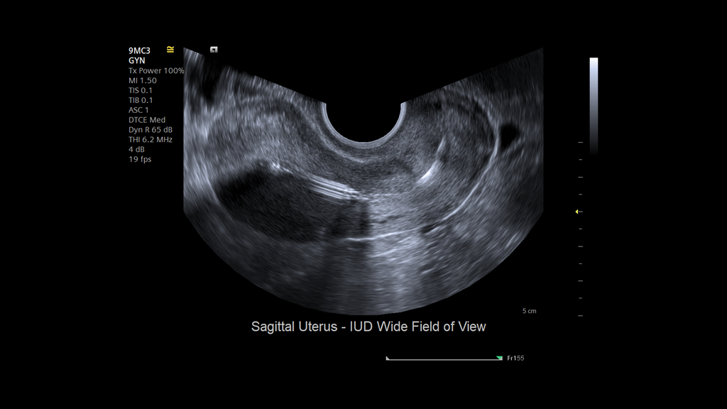 ACUSON Juniper is a High-Performance Shared Service Ultrasound System ...