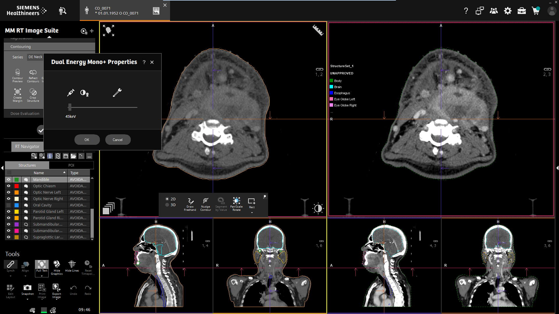 syngo.via RT Image Suite - Siemens Healthineers
