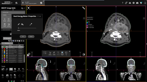 syngo.via RT Image Suite - Siemens Healthineers