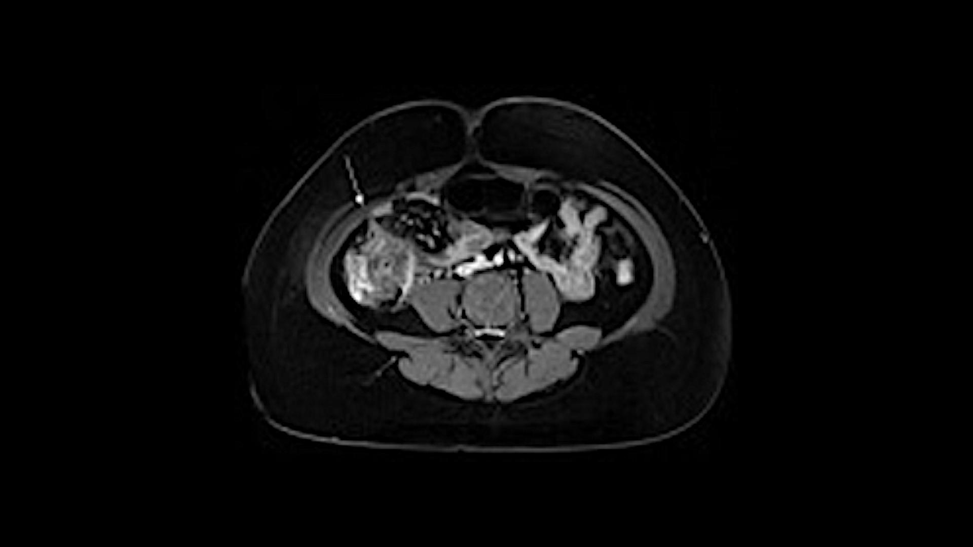 Pediatric MRI - Siemens Healthineers