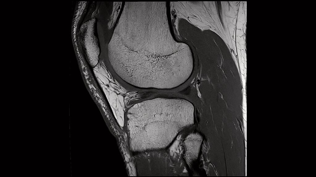 MAGNETOM Cima.X - Make the difference. - Siemens Healthineers