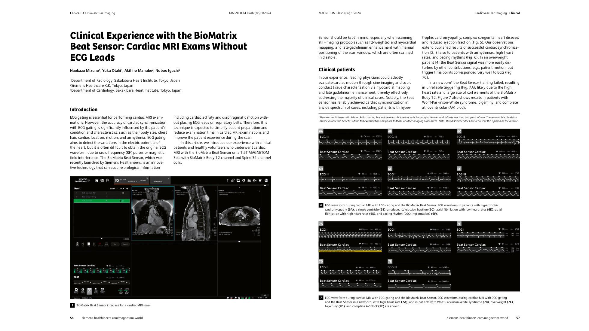 BioMatrix Beat Sensor