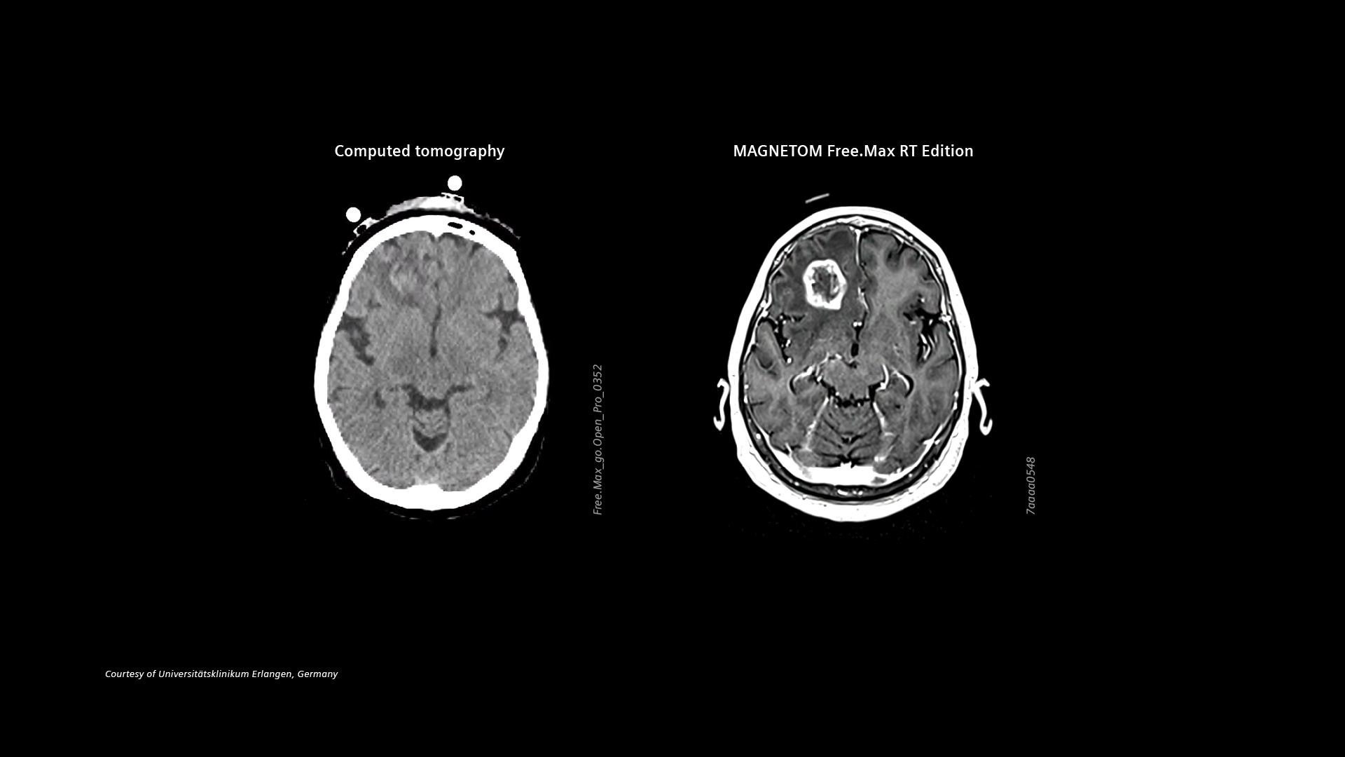 MAGNETOM Free.Max RT Edition - Siemens Healthineers India