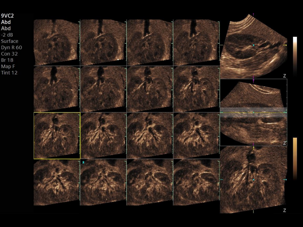 ACUSON Maple is a High-Performance Shared Service Ultrasound System ...