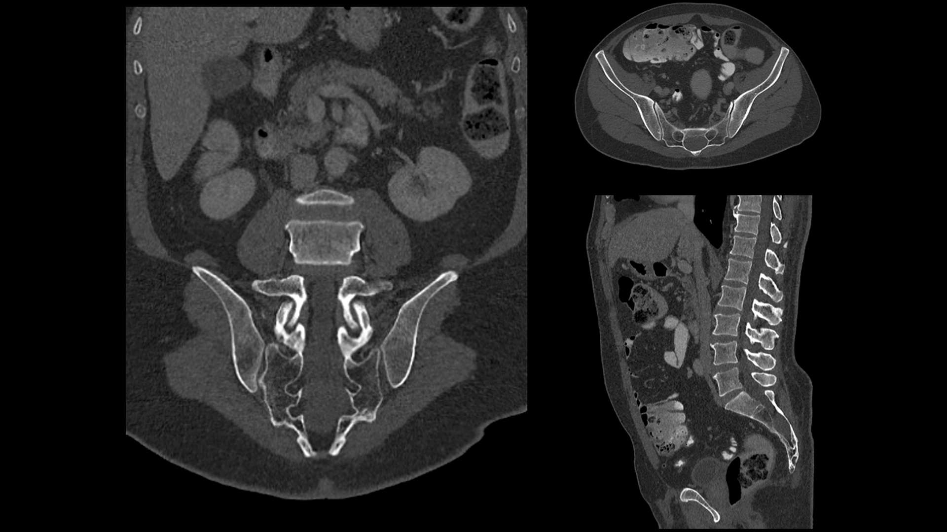 The Siemens Healthineers CT Imaging Chain - Siemens Healthineers
