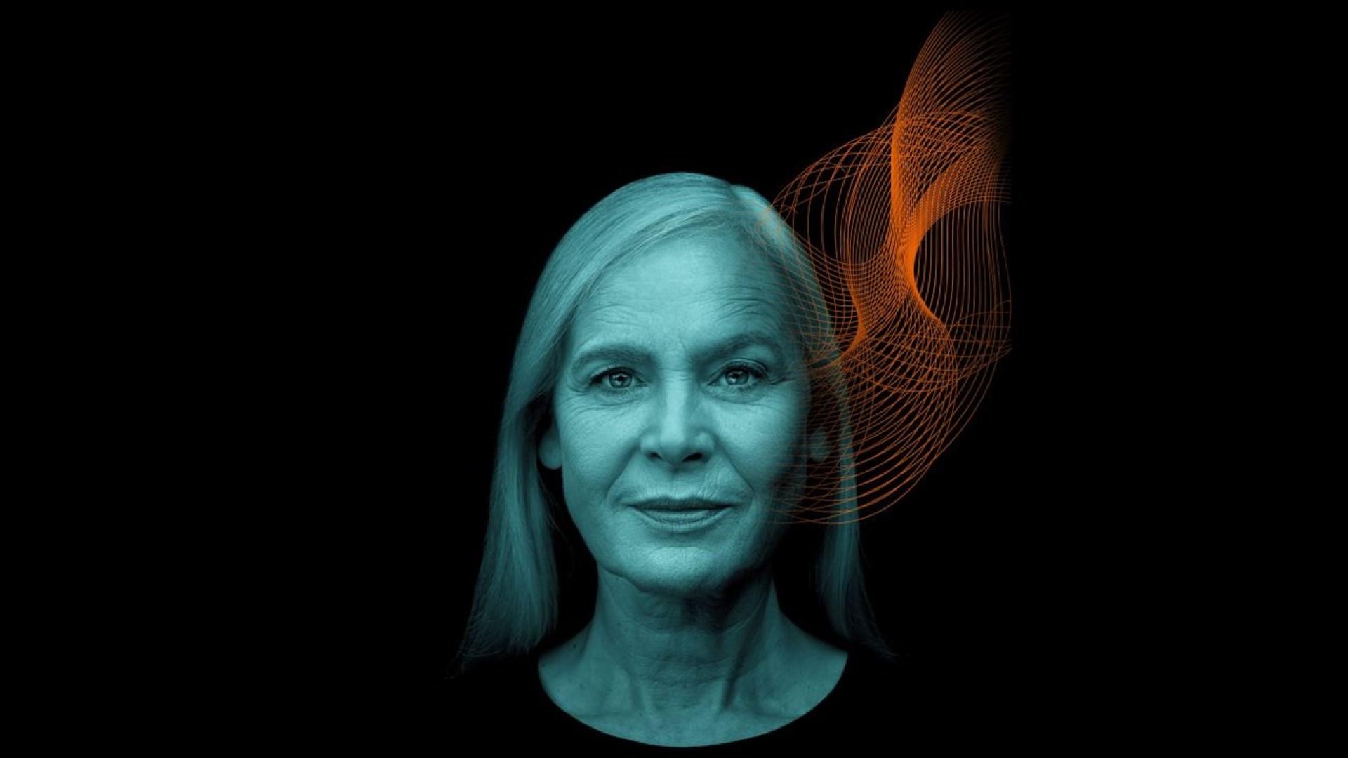 Beta-amyloid PET/CT imaging for Alzheimer's disease - Siemens ...