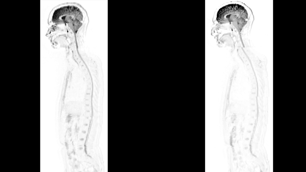 BioMatrix Technology - Siemens Healthineers