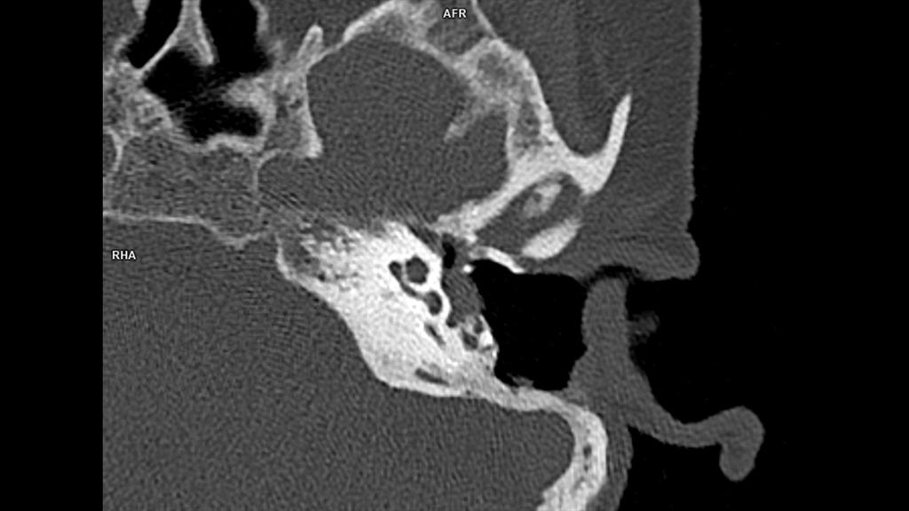 SOMATOM Pro.Pulse Dual Source CT scanner - Siemens Healthineers USA
