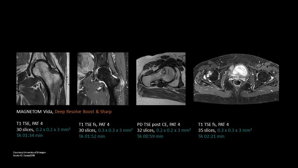 Deep Resolve - Siemens Healthineers USA