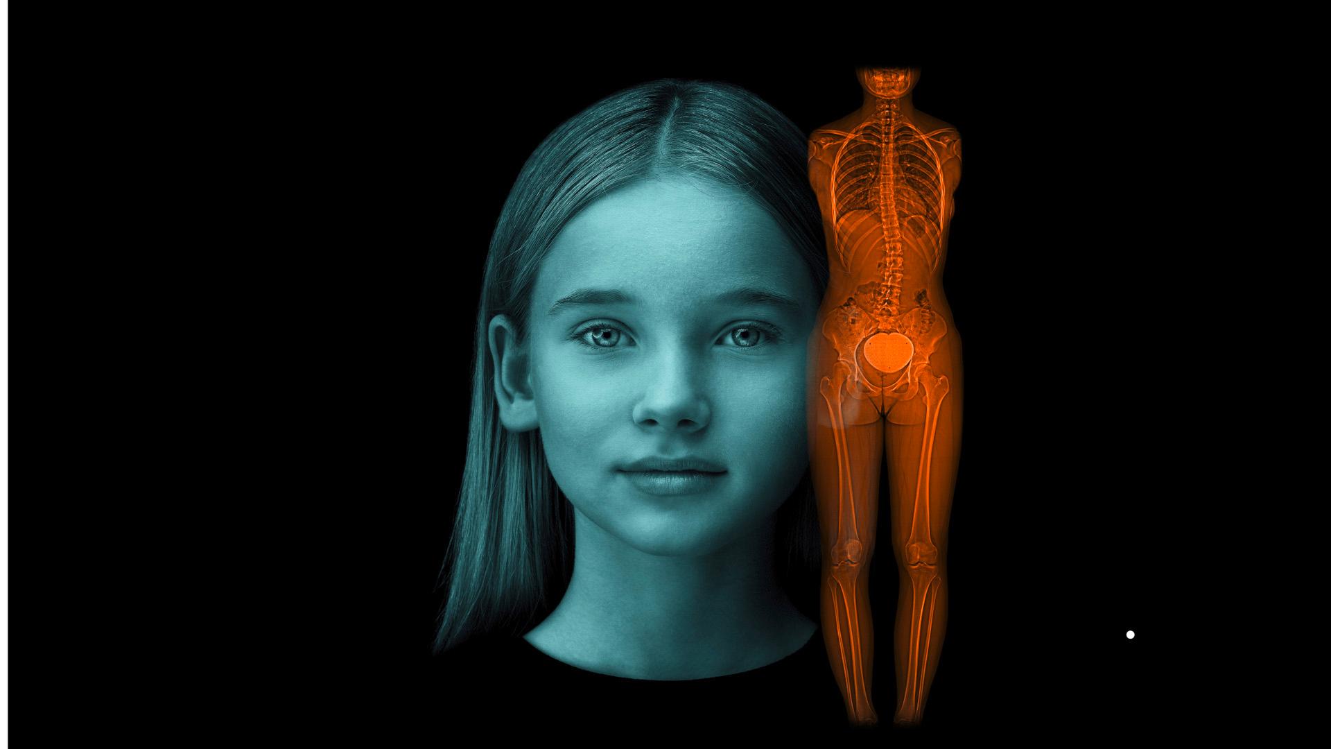 Multitom Rax In Clinical Use