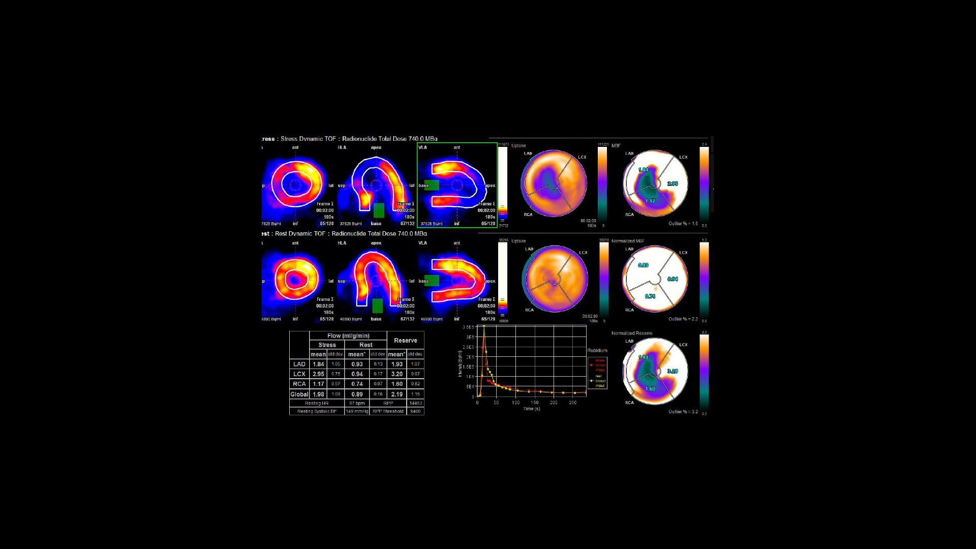 PET/CT delineation of multivessel coronary artery disease and post ...