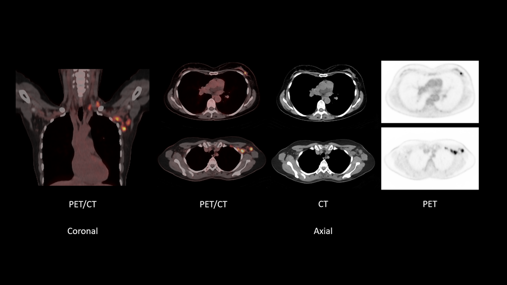 Biograph Vision Quadra PET/CT Scanner - Siemens Healthineers - Siemens ...