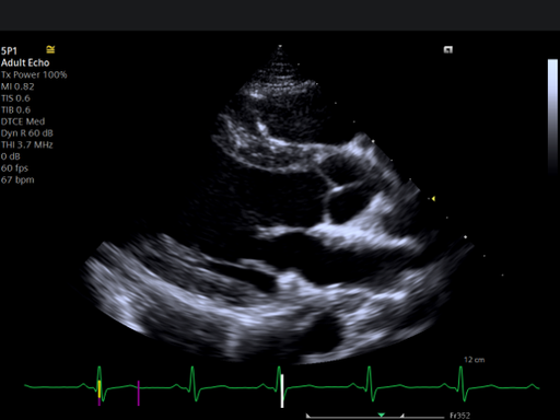 A New Era for Cardiac Imaging - Siemens Healthineers Singapore