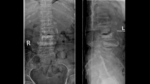 Twin Robotic X-ray scanner – Multitom Rax - Siemens Healthineers USA