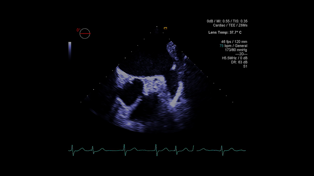 Cardiovascular Ultrasound | ACUSON SC2000 Ultrasound System - Siemens ...