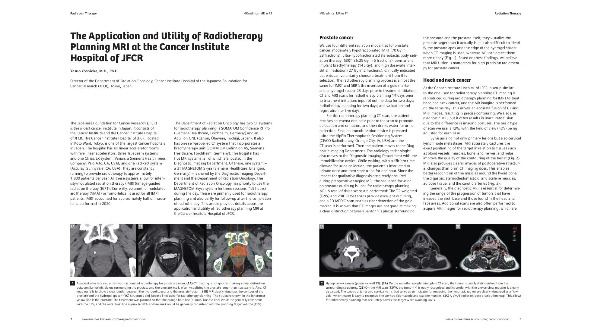 MRI for radiation therapy - Siemens Healthineers USA