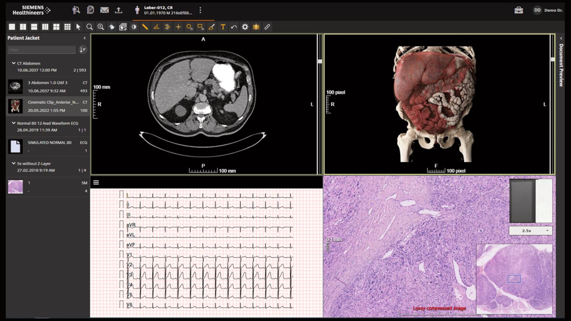 Liver Cancer Management - Siemens Healthineers