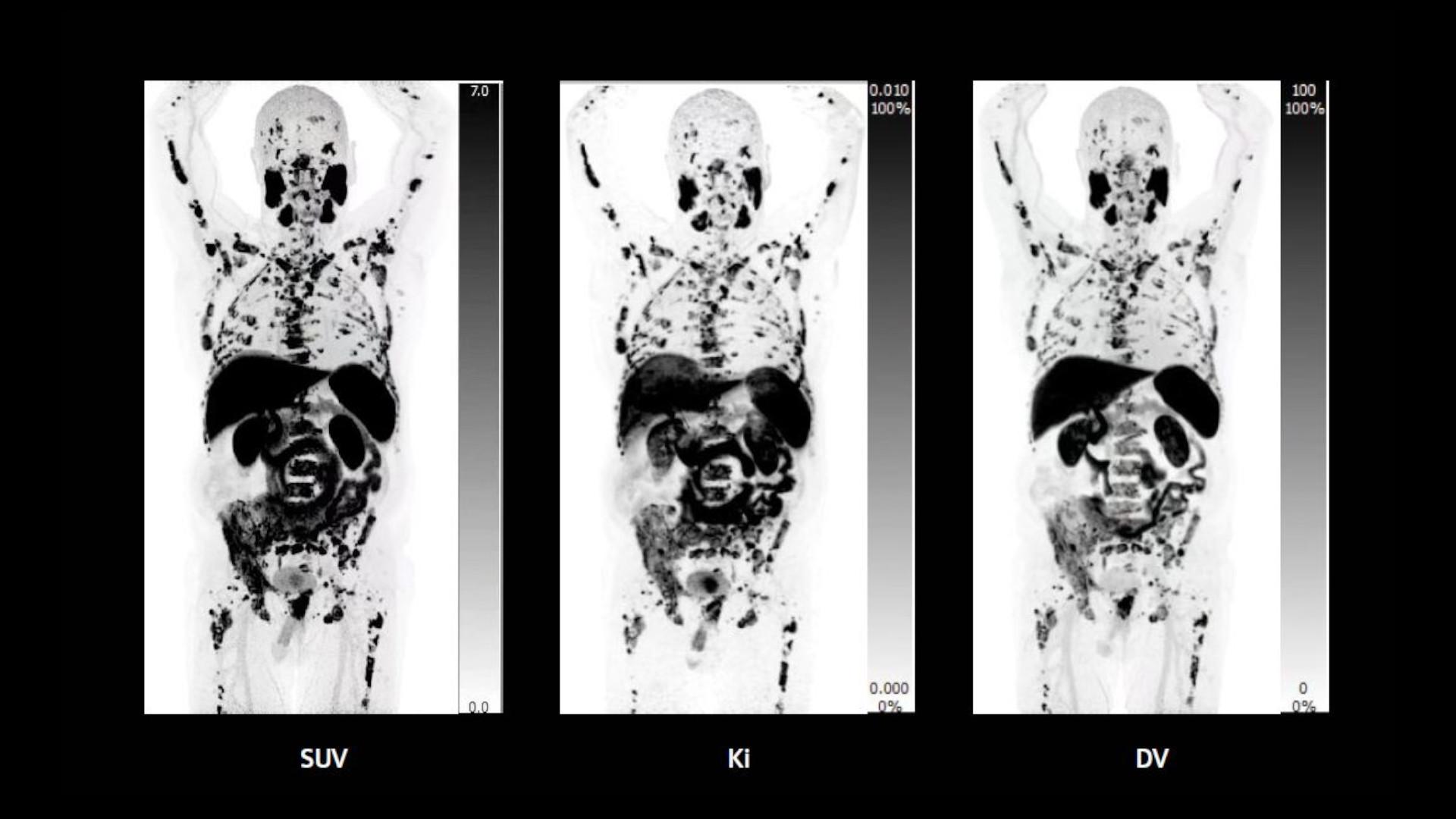 Total-body multiparametric PET/CT allows clinician researchers to see ...