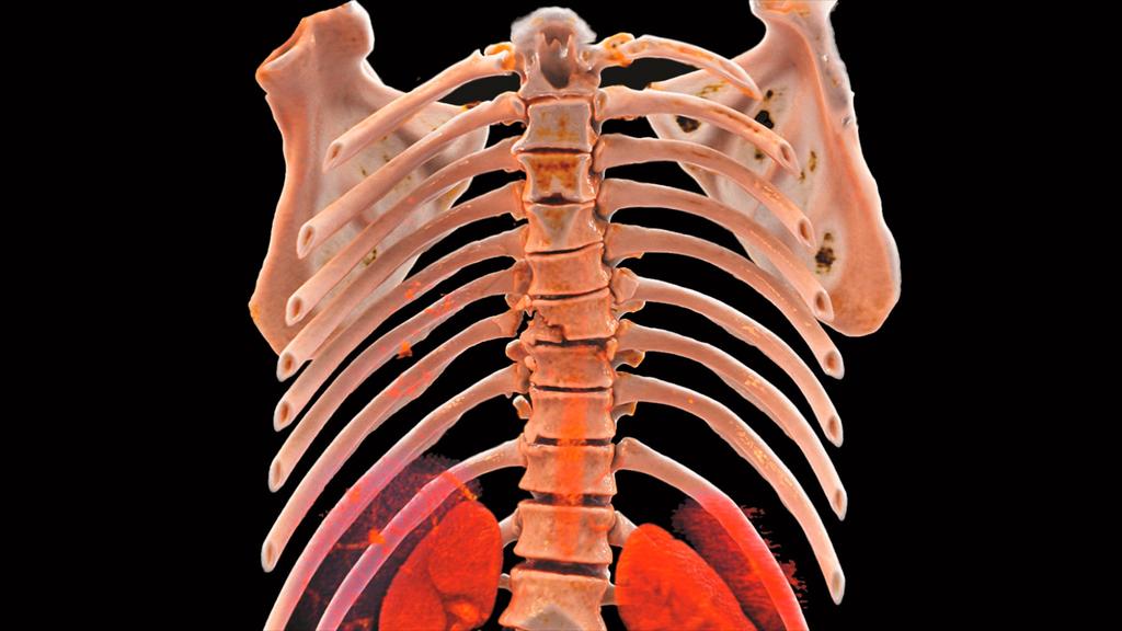 Computed Tomography - Siemens Healthineers