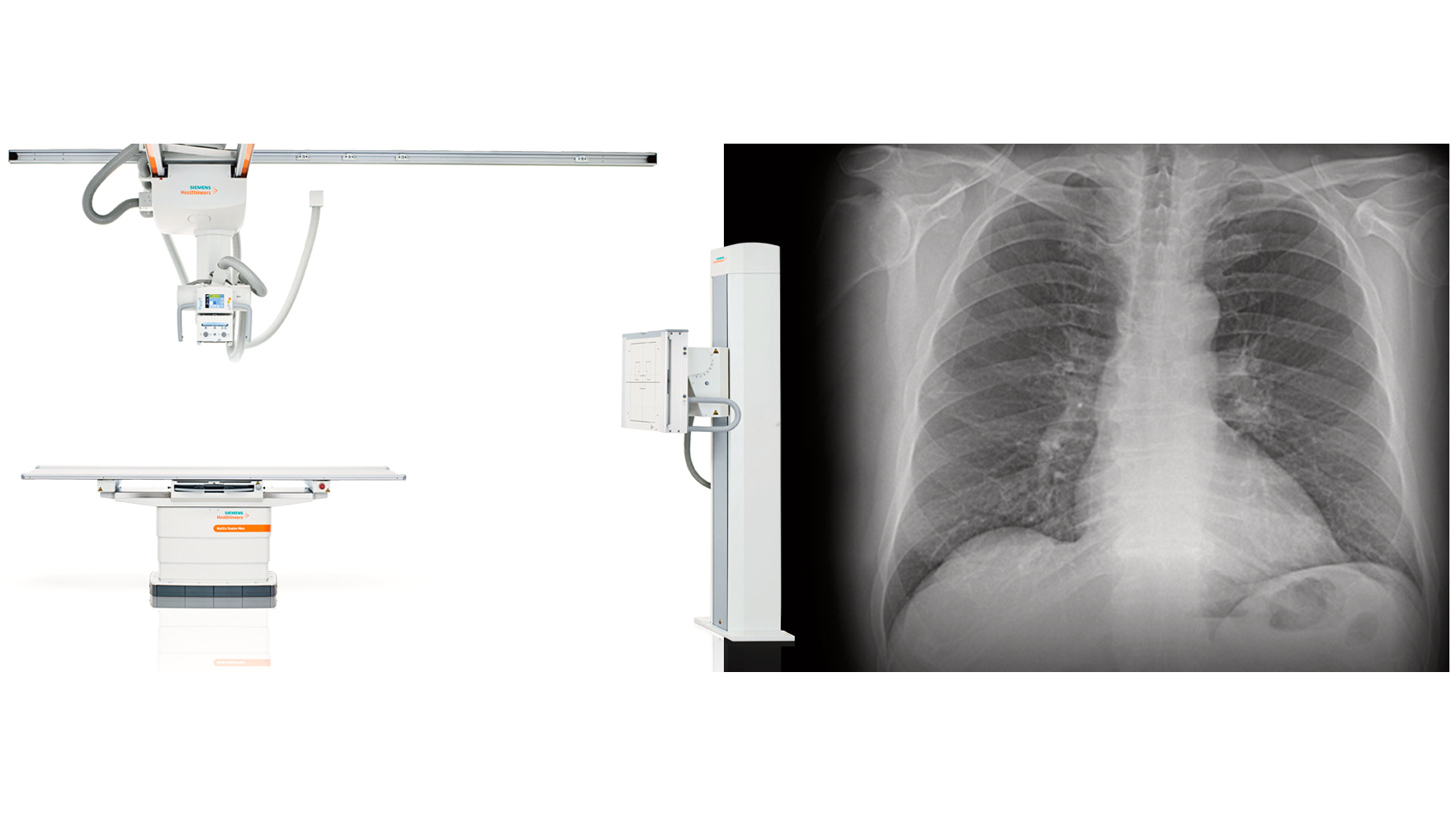 Multix Fusion Max - Digital Radiography Machine - Siemens Healthineers ...