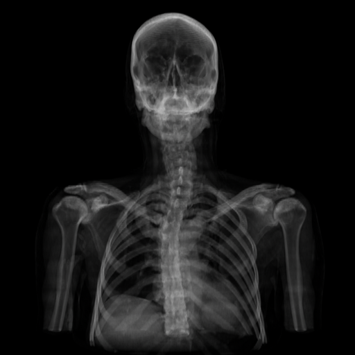 Computed Tomography simulation - Siemens Healthineers - Siemens ...