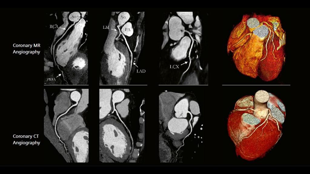 Make confident diagnostic decisions on Coronary Artery Diseases – fast ...