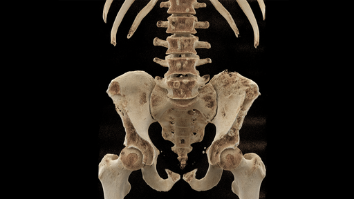 量子技術採用 NAEOTOM Alpha フォトンカウンティングCT - Siemens Healthineers Japan