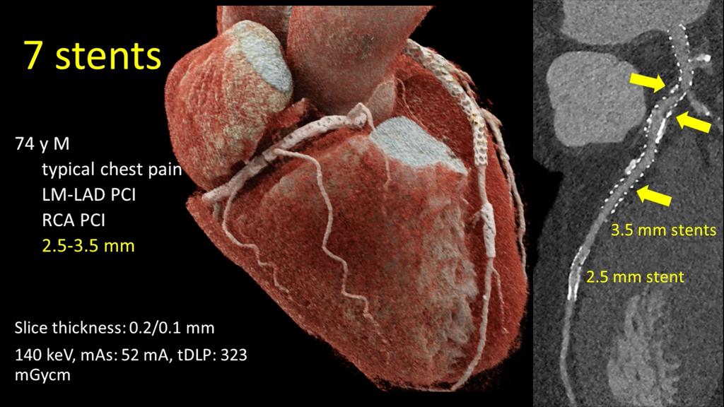 Computed Tomography Scientific Presentations - Siemens Healthineers USA