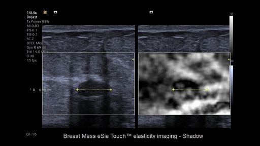 ACUSON Maple is a High-Performance Shared Service Ultrasound System ...