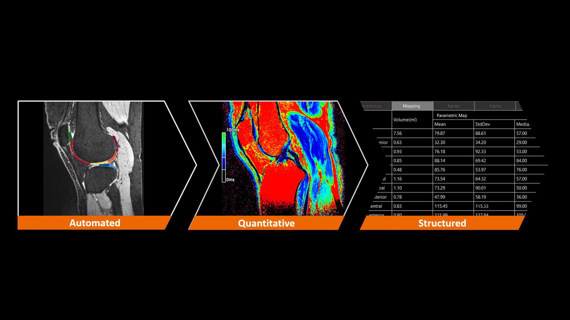 Musculoskeletal Imaging