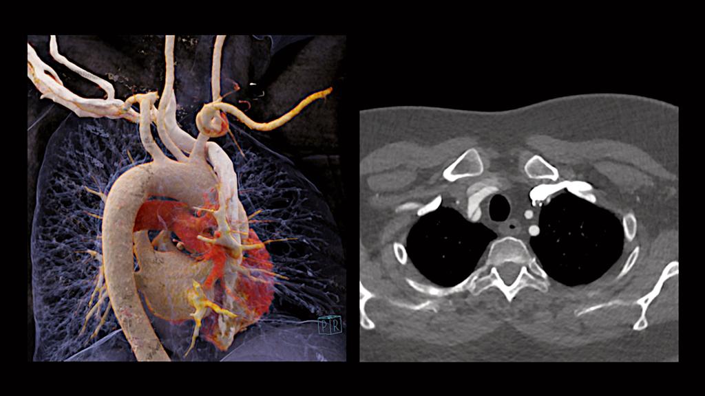 The Siemens Healthineers CT Imaging Chain - Siemens Healthineers