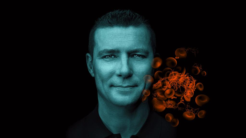 Integrated Platelet Aggregation Testing - Siemens Healthineers