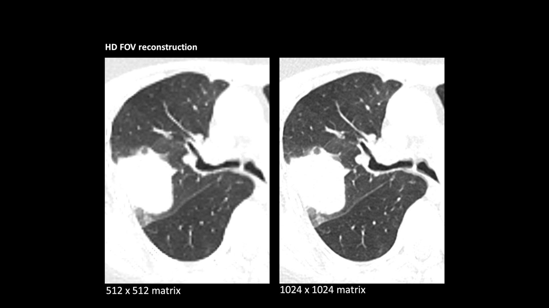 SOMATOM go.Sim - Siemens Healthineers