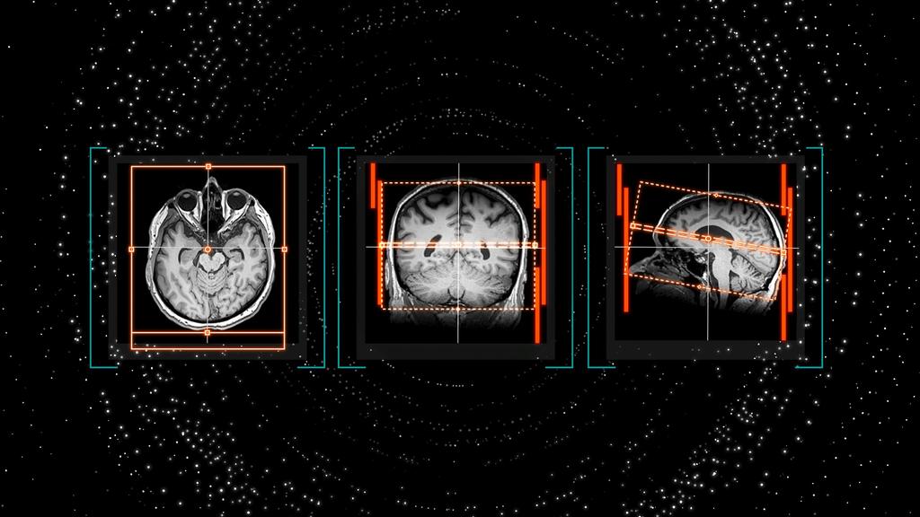 MAGNETOM Cima.X - Make the difference. - Siemens Healthineers