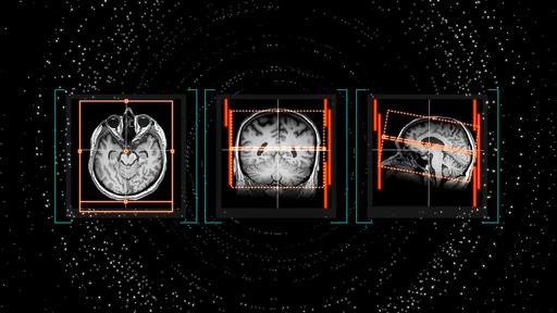 MAGNETOM Cima.X - Make the difference. - Siemens Healthineers