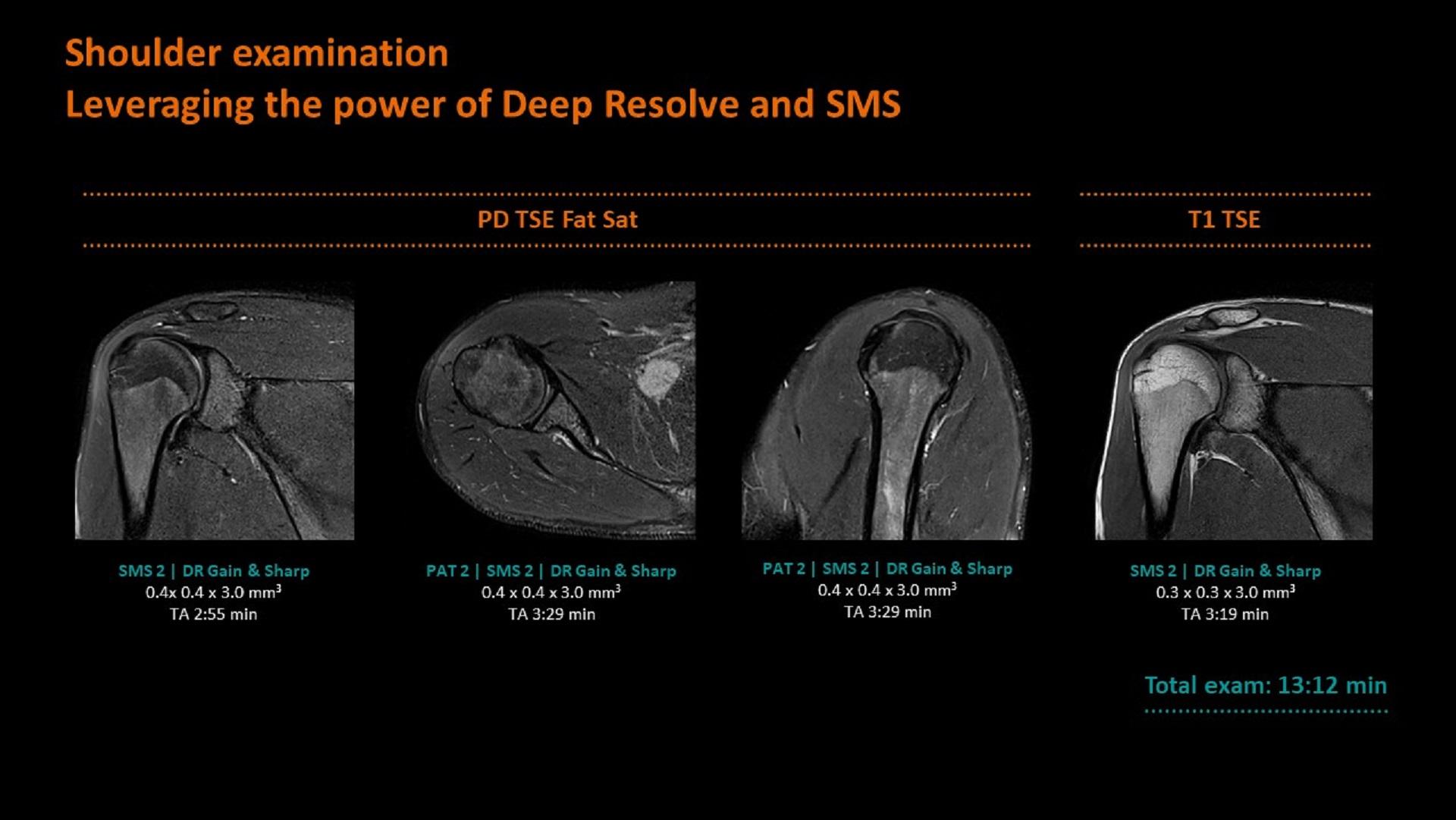 MAGNETOM Free.Max–wide bore mri - Siemens Healthineers Japan