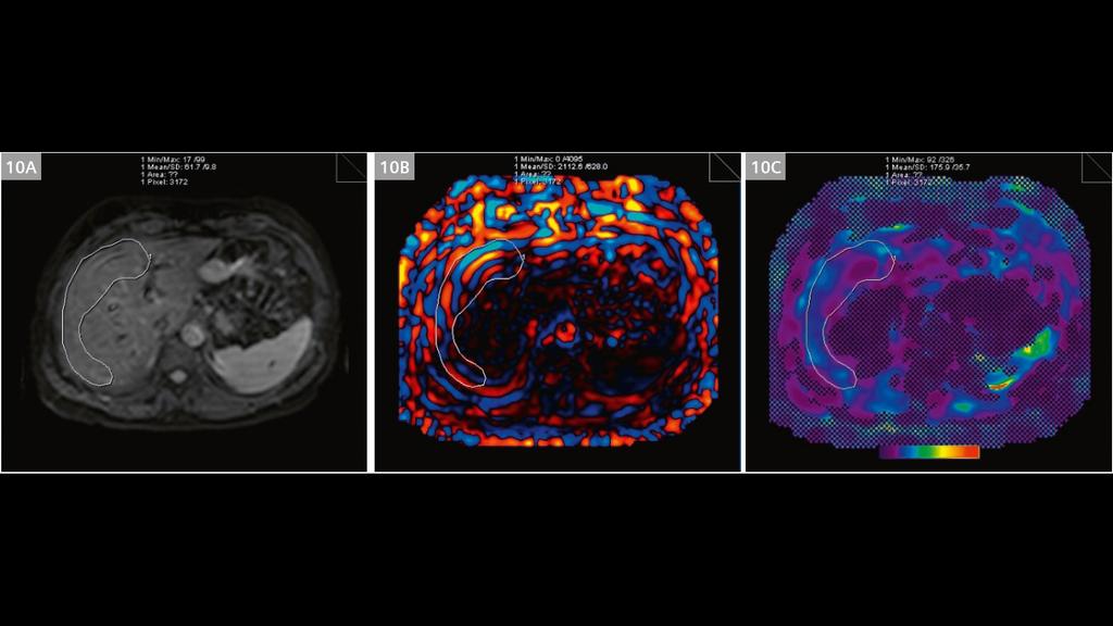 MRI Case Studies, MRI Case Study, MRI Case