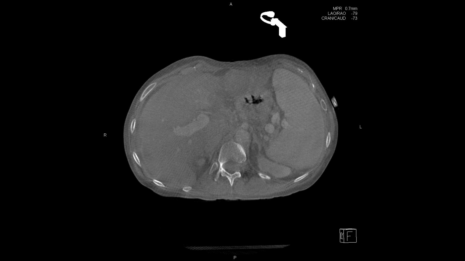 syngo DynaCT - Siemens Healthineers