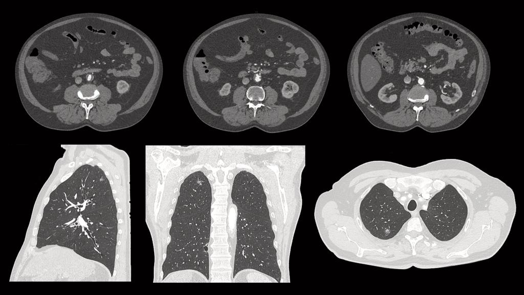 The Siemens Healthineers CT Imaging Chain - Siemens Healthineers