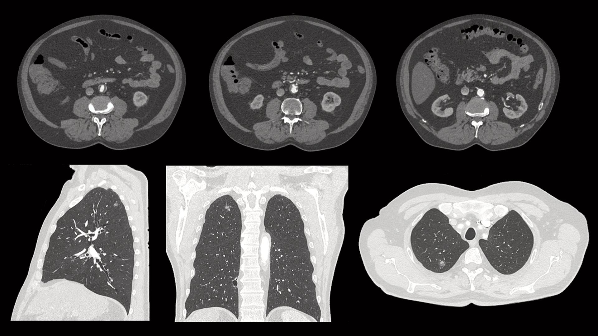 The Siemens Healthineers CT Imaging Chain - Siemens Healthineers